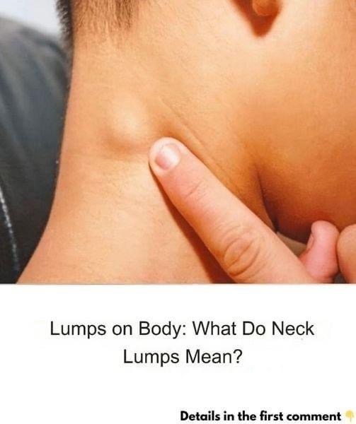 When to worry about neck lumps and what to do about them – STORY MAGAZINE