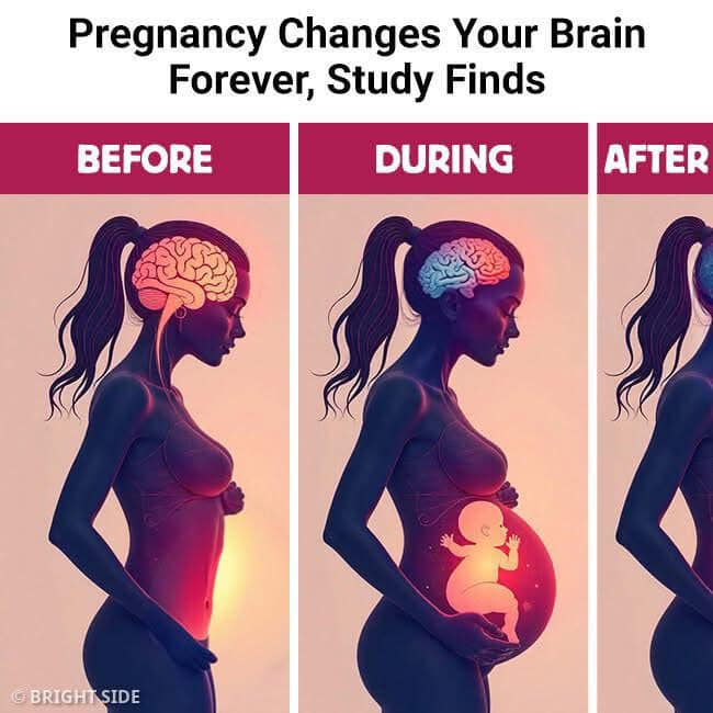 Pregnancy Changes Your Brain Forever, Study Finds – STORY MAGAZINE